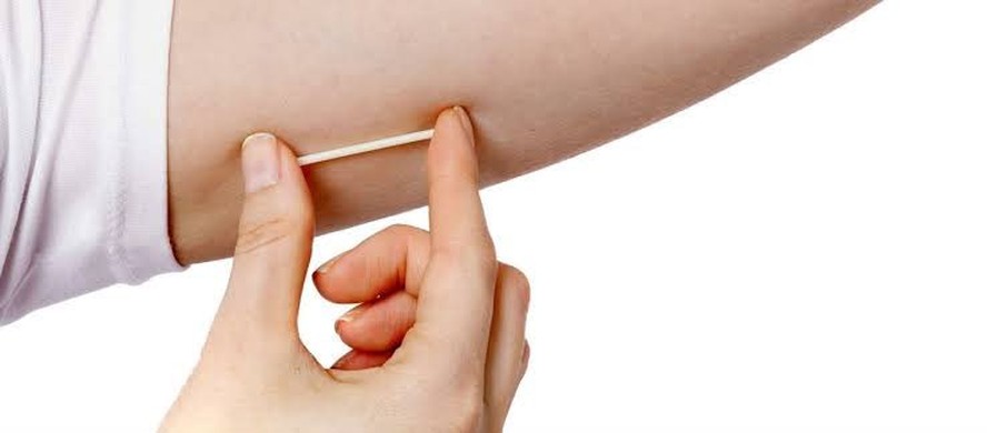 Mesmo após Anvisa proibir 'chip da beleza', cursos de implantes ...