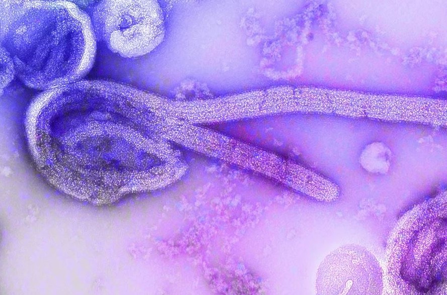 Como o ebola é transmitido e qual o risco para o Brasil?