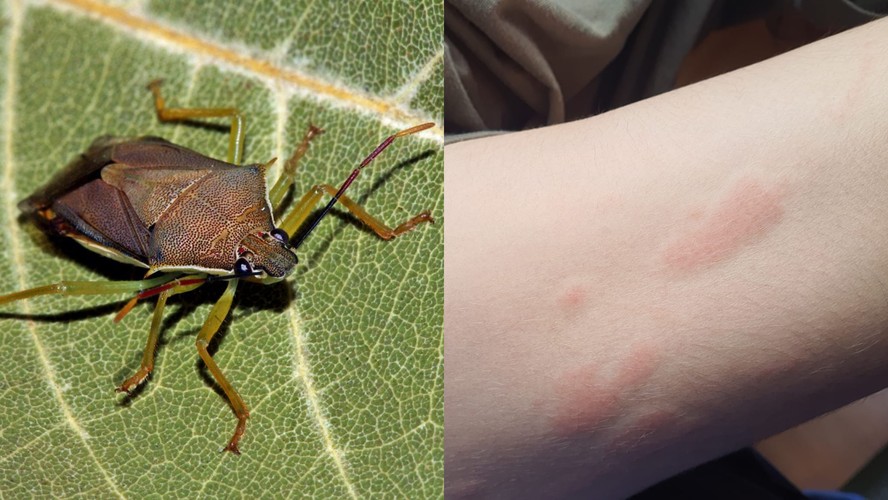 Infestação de percevejos: frequentadores relatam picadas em bares do ...