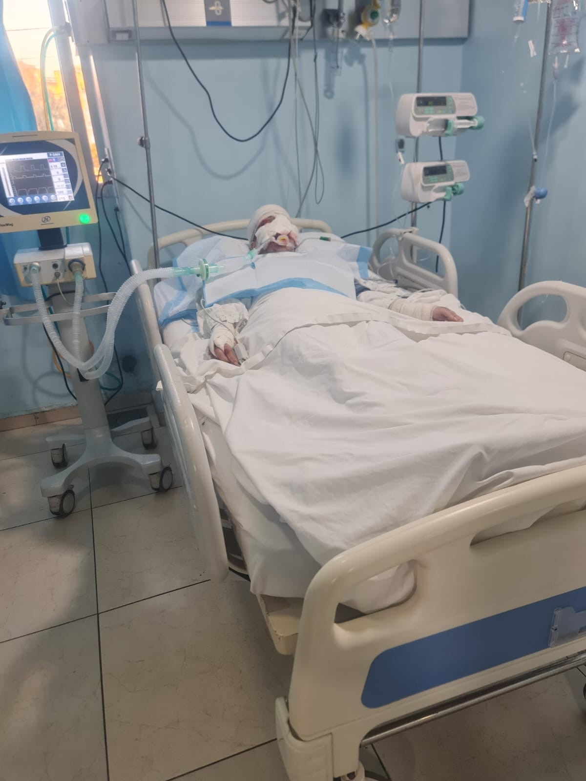 Marido de brasileira ferida em bombardeio no Líbano está em estado de choque no Brasil | Mundo | cbn